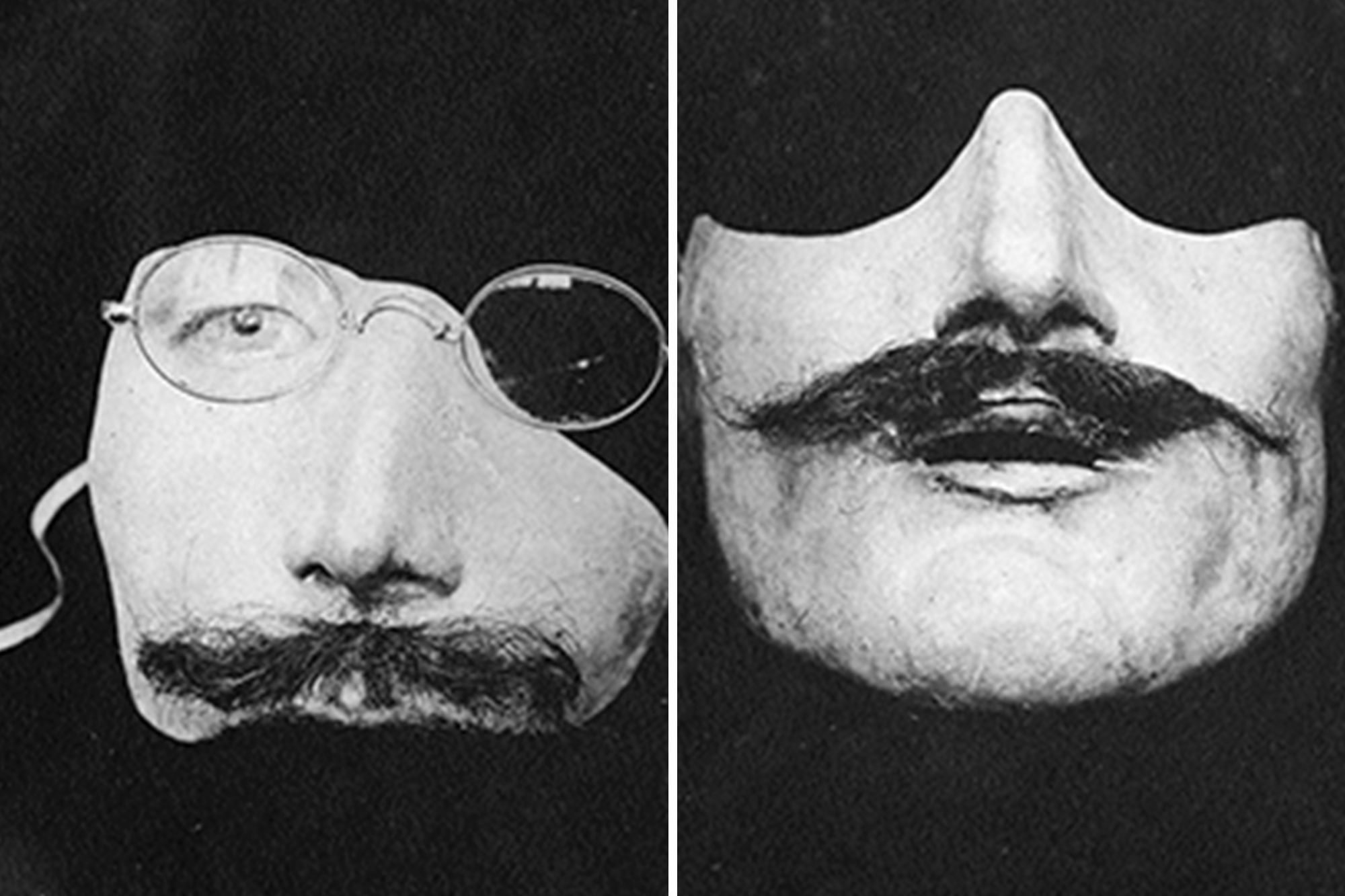 The Man Who Fixed The Faces. The Father Of Plastic Surgery. – South ...